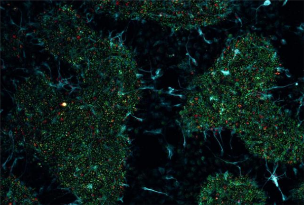 全球首台商用生物计算机CL1亮相巴塞罗那_人工智能-中关村在线